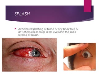 Needle stick, splash, spill | PPT