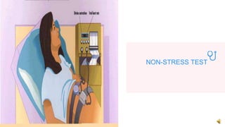 NST.pptx | Pregnancy | Reproductive Health