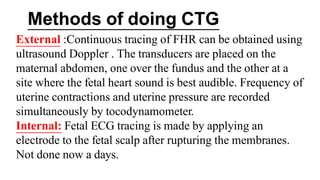 NST, biophysical score, cardiotocography(CTG).pdf