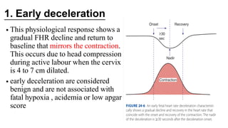NST, biophysical score, cardiotocography(CTG).pdf