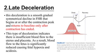 NST, biophysical score, cardiotocography(CTG).pdf