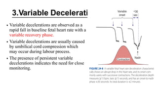 NST, biophysical score, cardiotocography(CTG).pdf