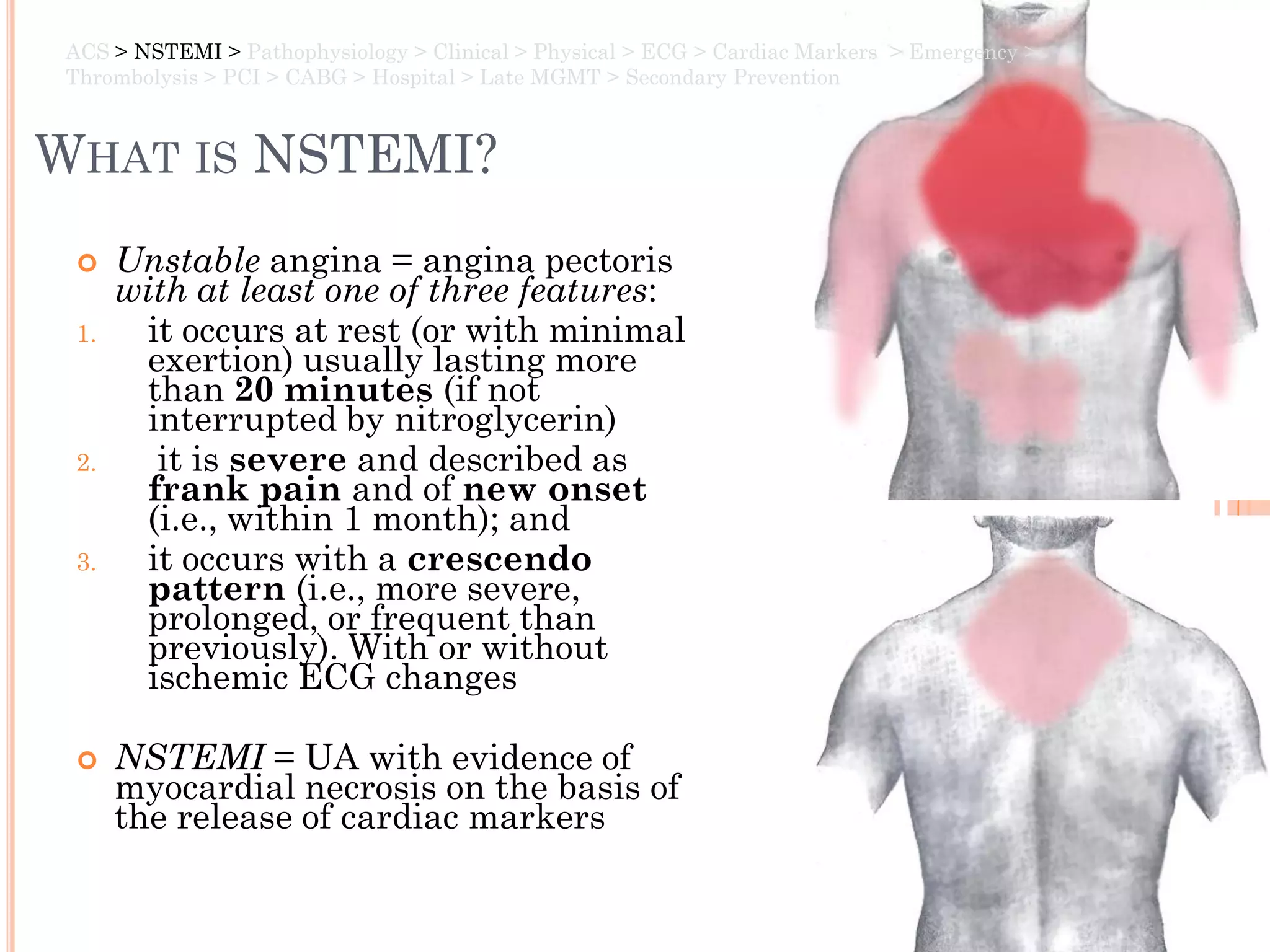 NSTEMI DrHafiz | PDF