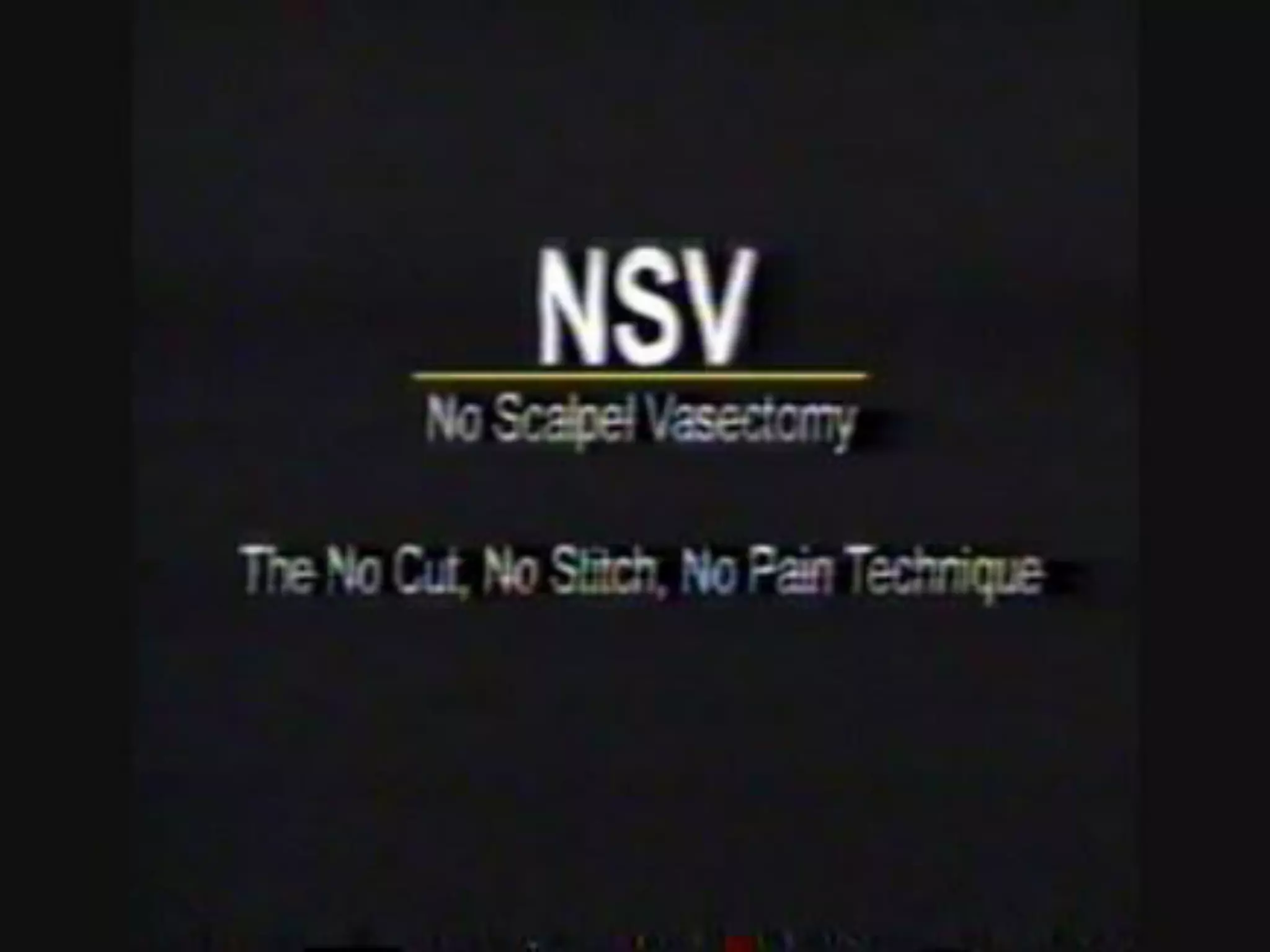 NO SCALPEL VASECTOMY(NSV) | PDF