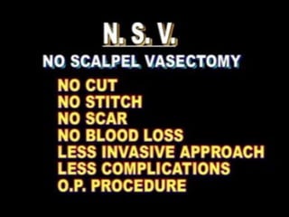 NO SCALPEL VASECTOMY(NSV) | PDF