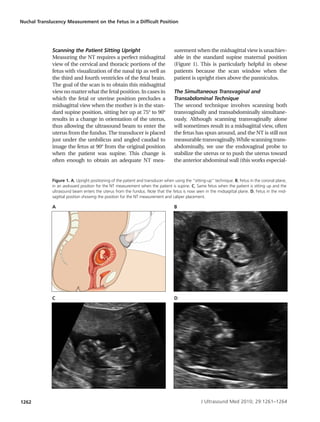 Nuchal Translucency Measurement on the Fetus in a Difficult Position | PDF