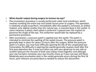 Nt6 health education of eye tumour revised | PPT