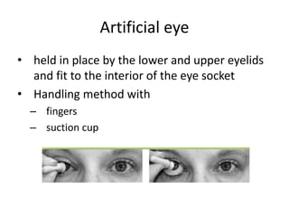 Nt6 health education of eye tumour revised | PPTX