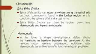 Neural tube defects - in neonates and children | PDF