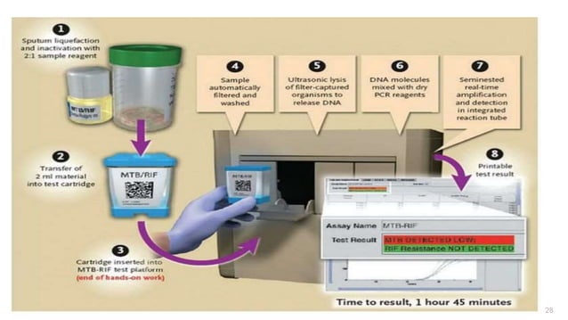 NTEP GUIDELINES Presentation By Dr Aiswarya Thambi.pptx | Lung and ...