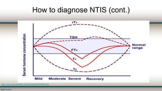 Thyroid and Critical Illness - NTI | PPTX