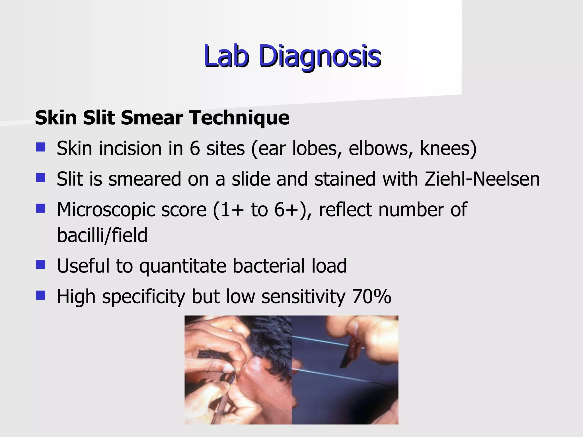 Ntm m leprae leprosy | PPT