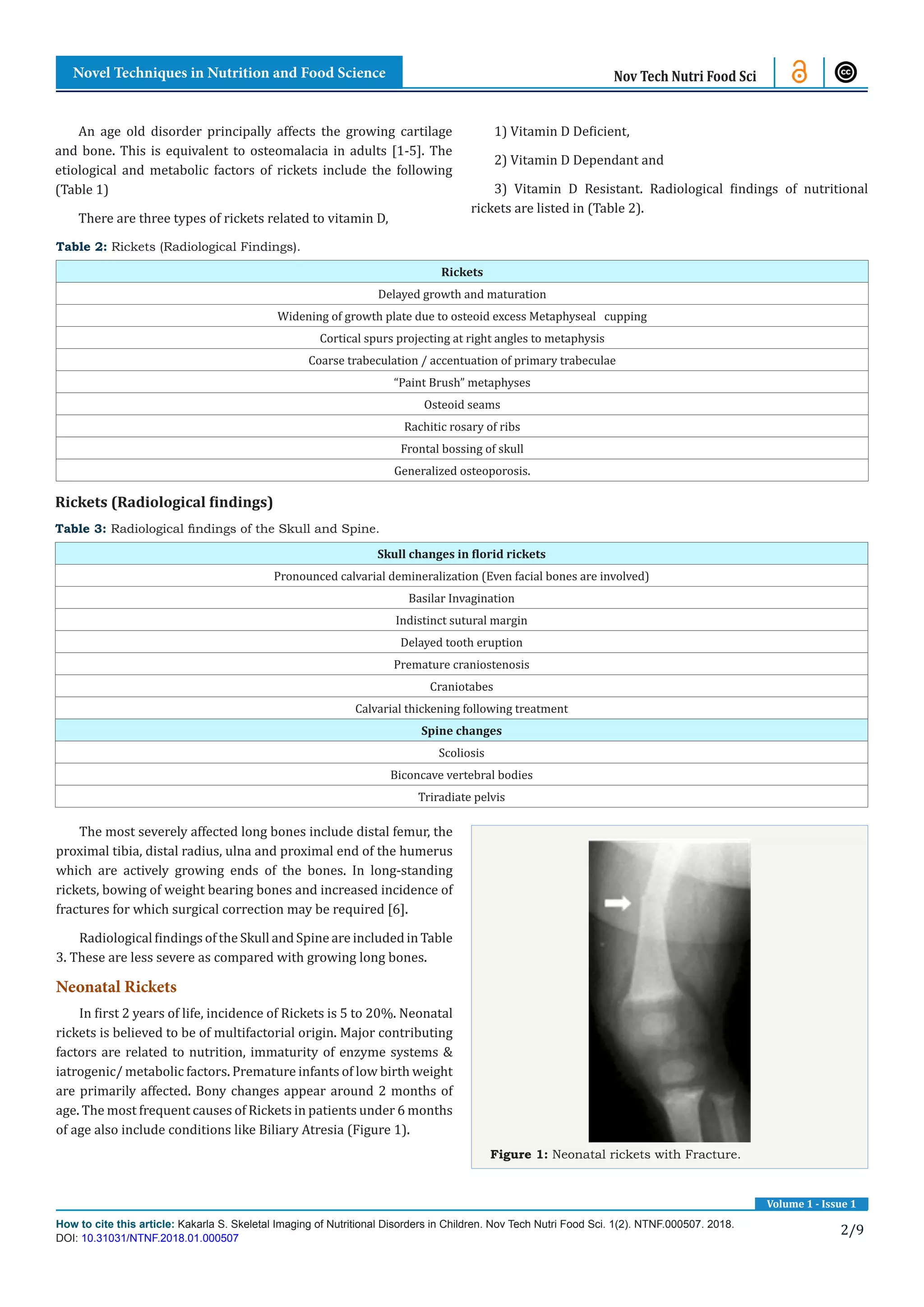 Skeletal Imaging of Nutritional Disorders in Children_Crimson ...