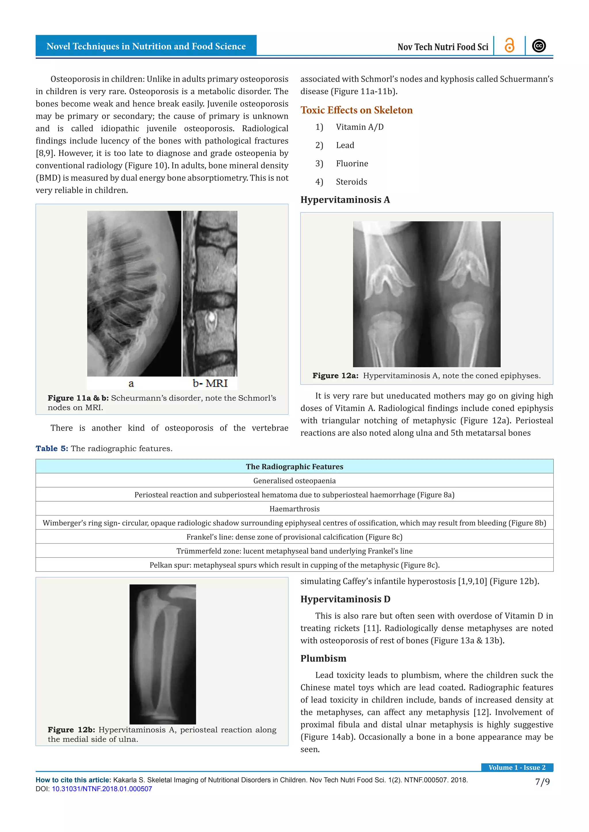 Skeletal Imaging of Nutritional Disorders in Children_Crimson ...