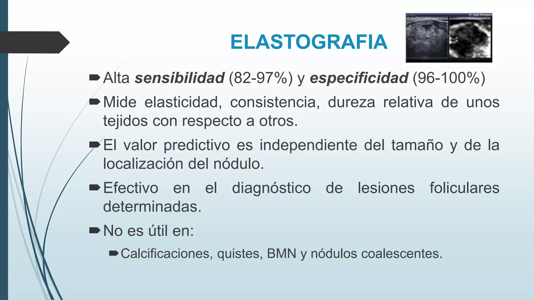 Diagnóstico y manejo del nódulo tiroideo | PPTX