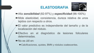 Diagnóstico y manejo del nódulo tiroideo | PPTX