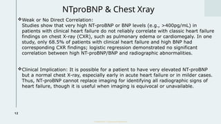 NT pro-BNP as a biomarker in acute care setting | PPTX