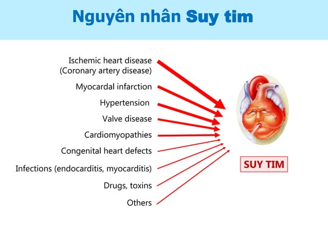 NT-proBNP trong chẩn đoán Suy tim | PDF