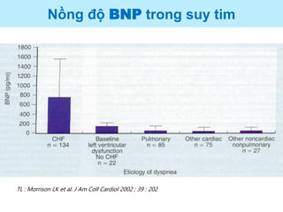 NT- proBNP trong Suy tim | PDF