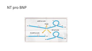 Nt pro BNP | PPTX