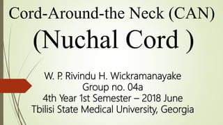 Cord-Around-the Neck (Nuchal Cord) - Rivin | PPTX