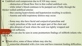 Cord-Around-the Neck (Nuchal Cord) - Rivin | PPTX