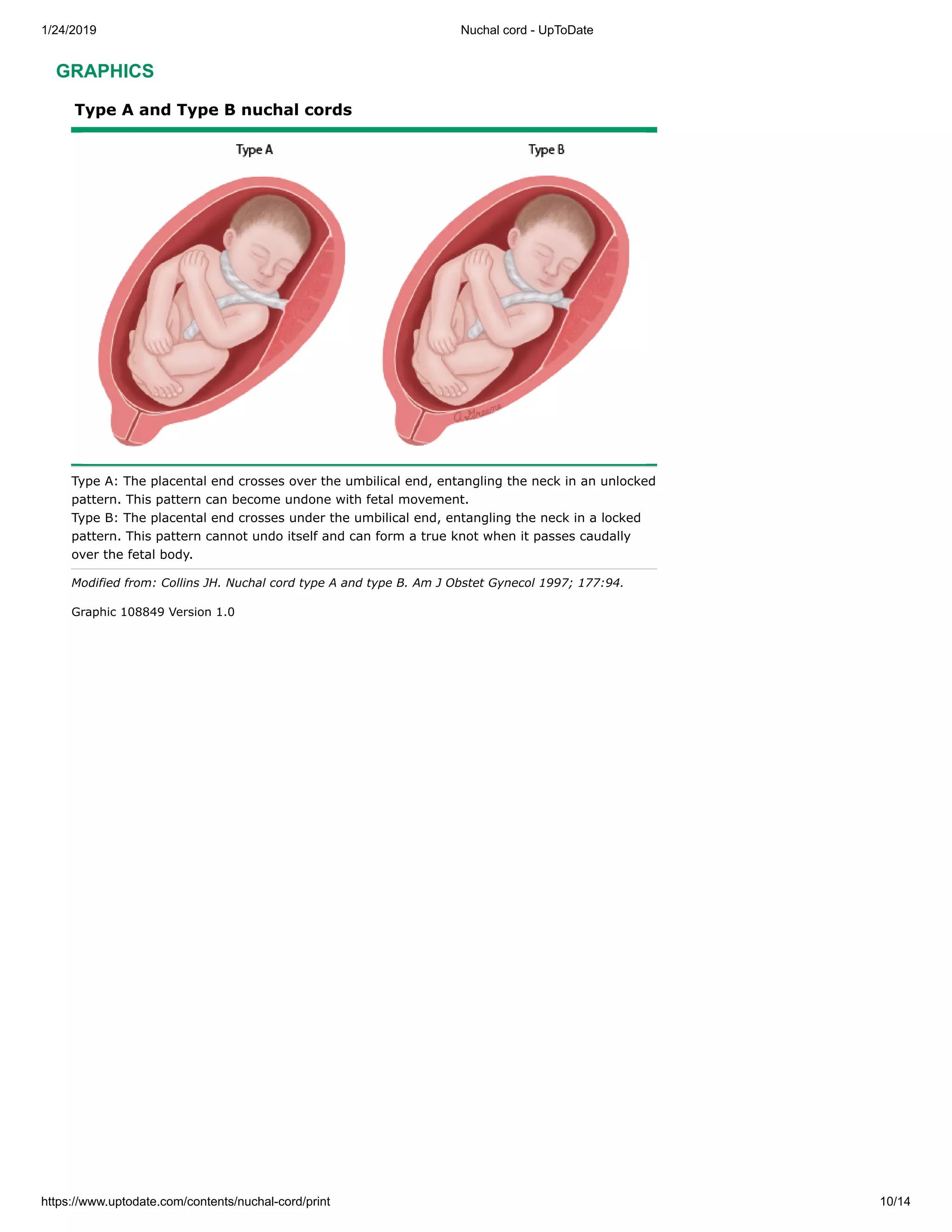 Nuchal cord - uptodate 2019 day ron quan co thai nhi | PDF