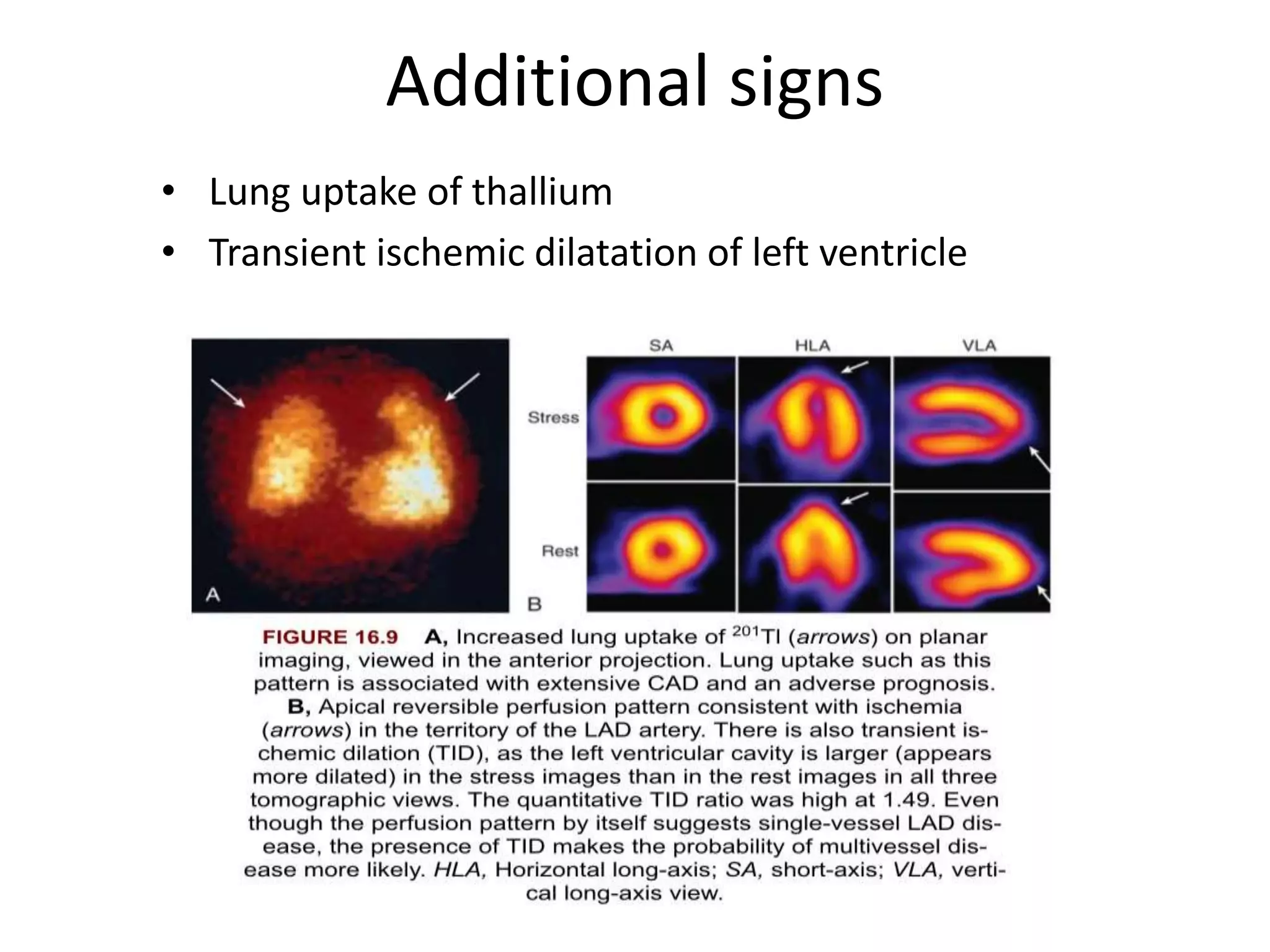 Nuclear cardiology | PPTX
