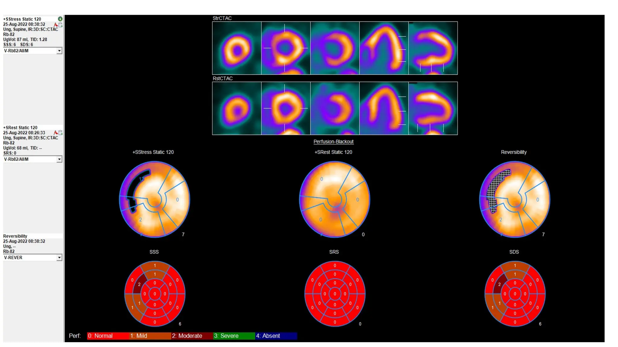 NUCLEAR CARDIOLOGY111111111111111nov.pptx