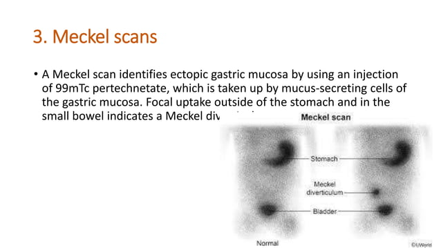 Nuclear gastrointestinal scans | PPTX | Digestive Disorders | Diseases ...