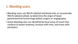 Nuclear gastrointestinal scans | PPTX