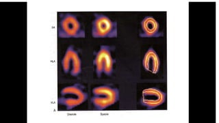 Nuclear imaging | PPTX