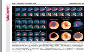 Nuclear imaging | PPTX
