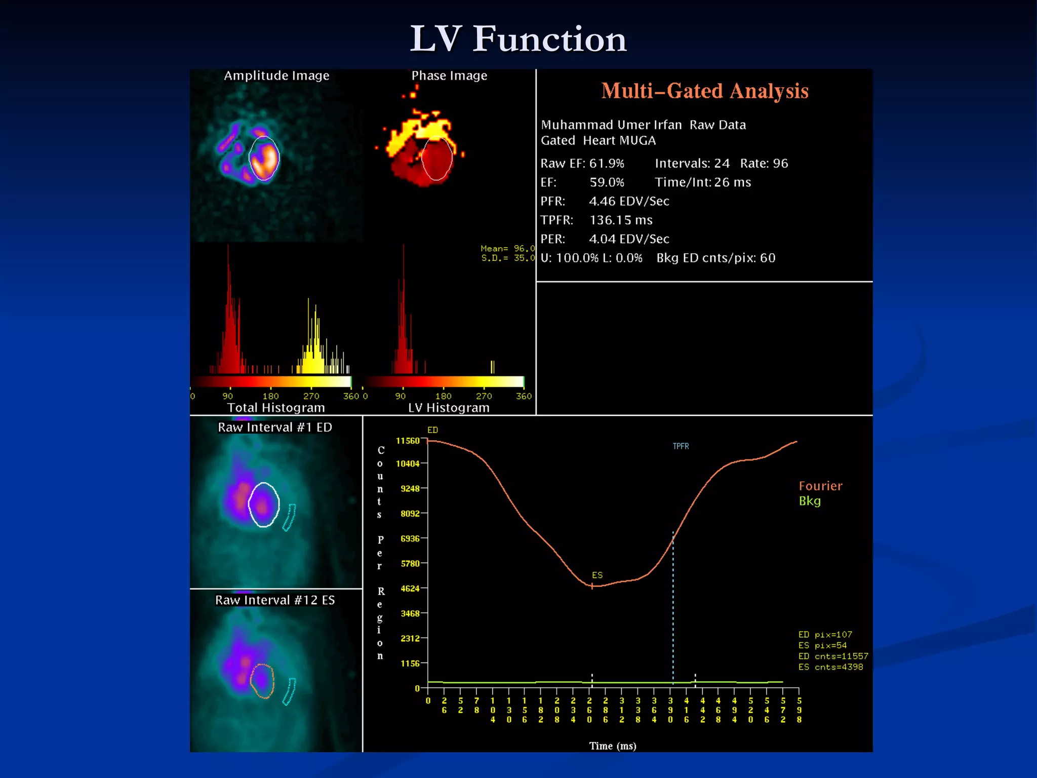 Nuclear Imaging In Cardiology Cme | PPT