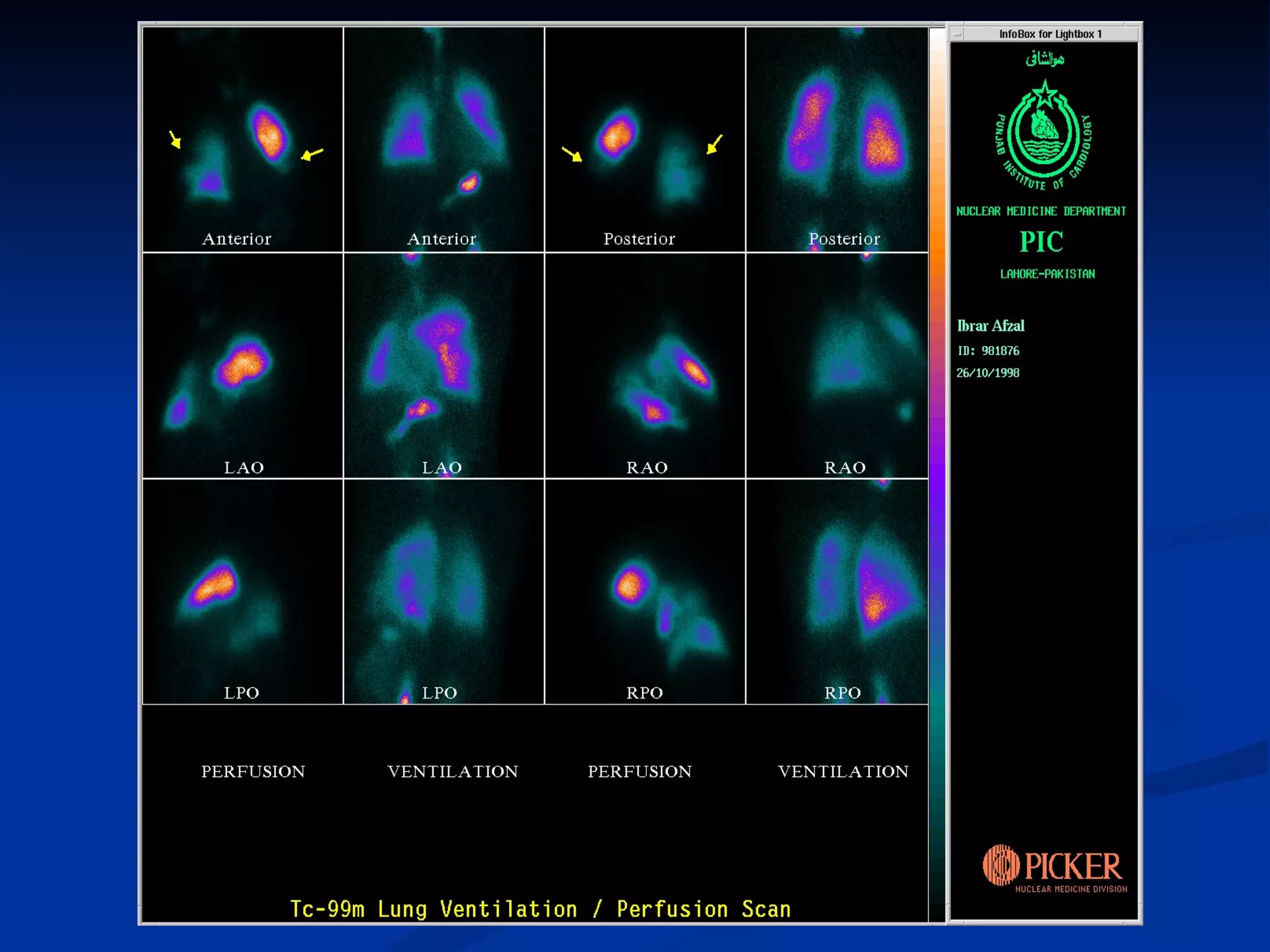 Nuclear Imaging In Cardiology Cme | PPT