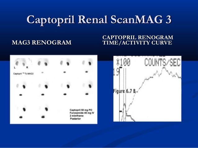 Nuclear imaging in kidney disease