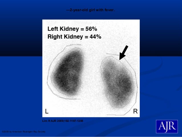 Nuclear imaging in kidney disease