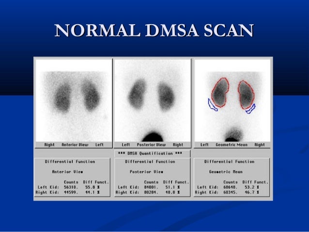 Nuclear imaging in kidney disease