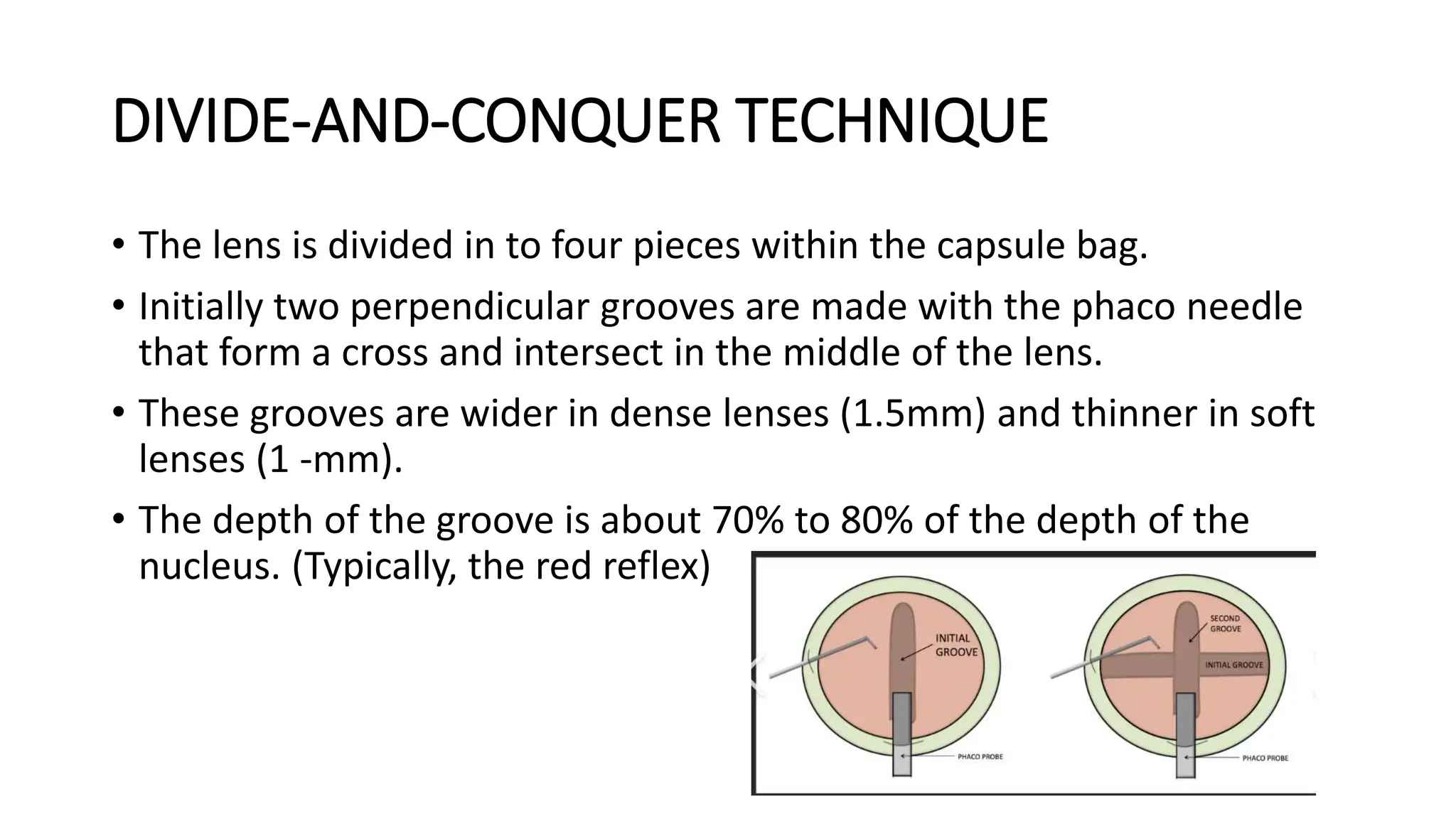 Phaco emulsification nuclear management techniques | PPTX