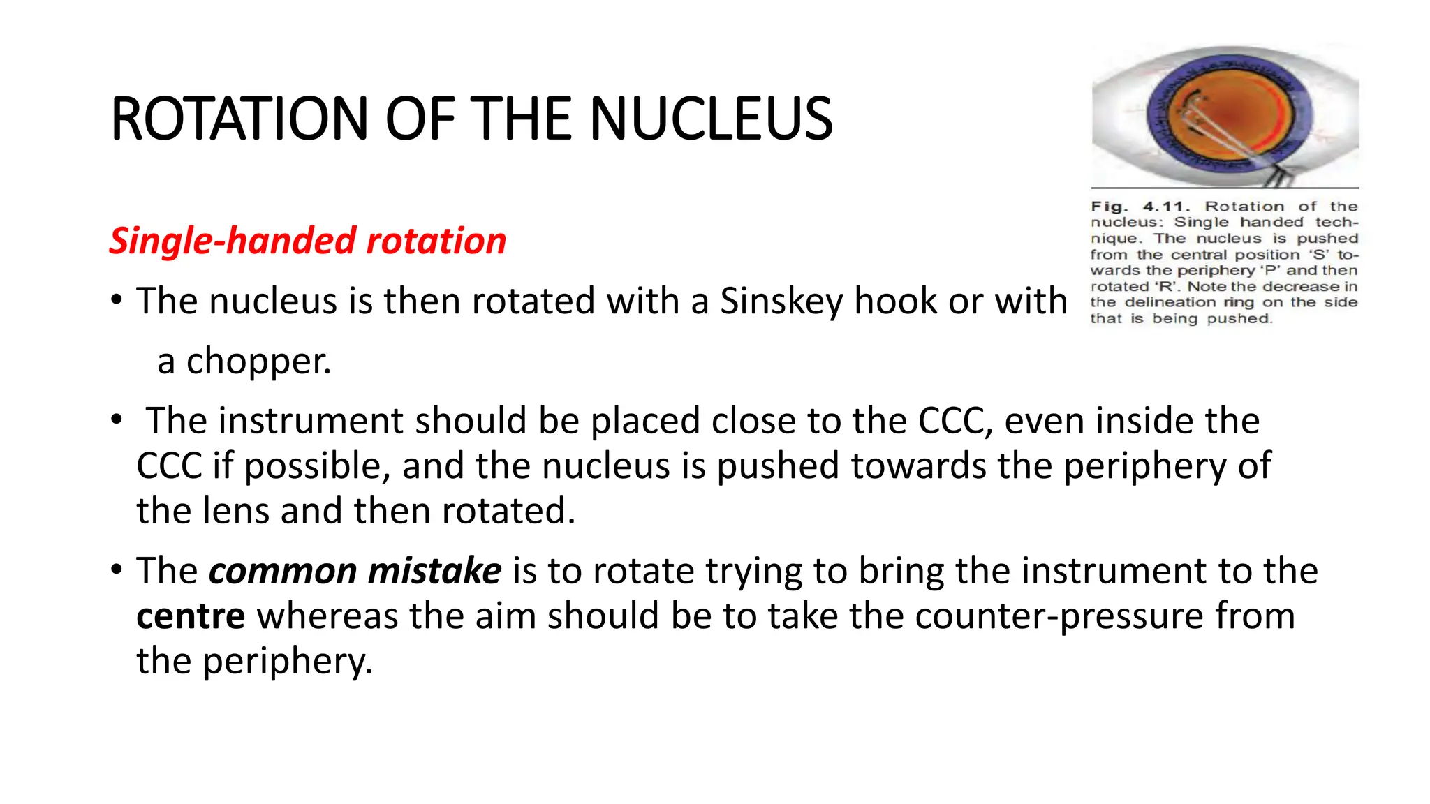 Phaco emulsification nuclear management techniques | PPTX