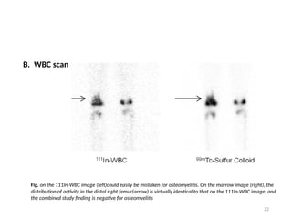 Nuclear Medecine Infection and inflammation Imaging.pptx
