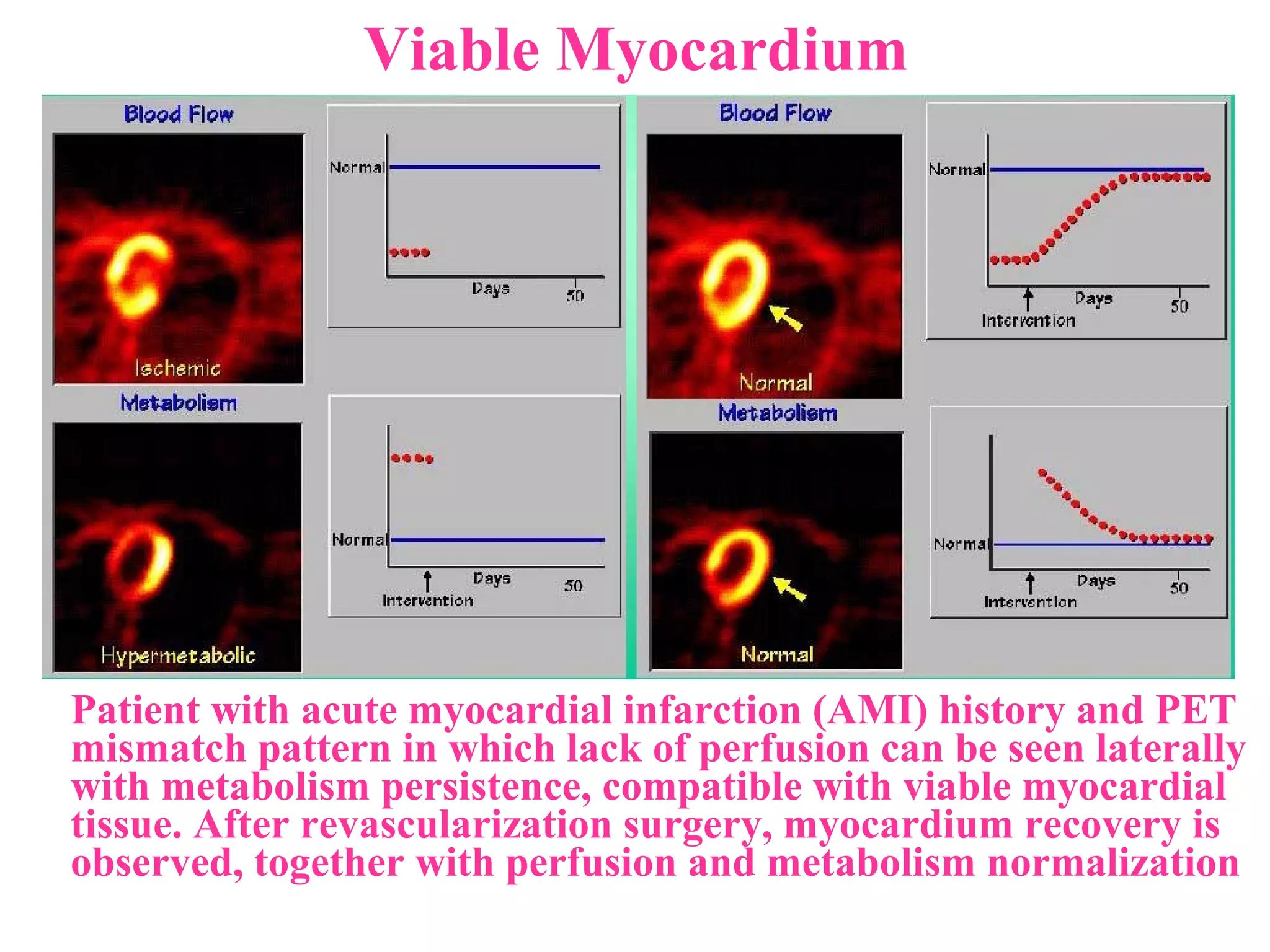 Nuclear imaging and PET physics | PPT