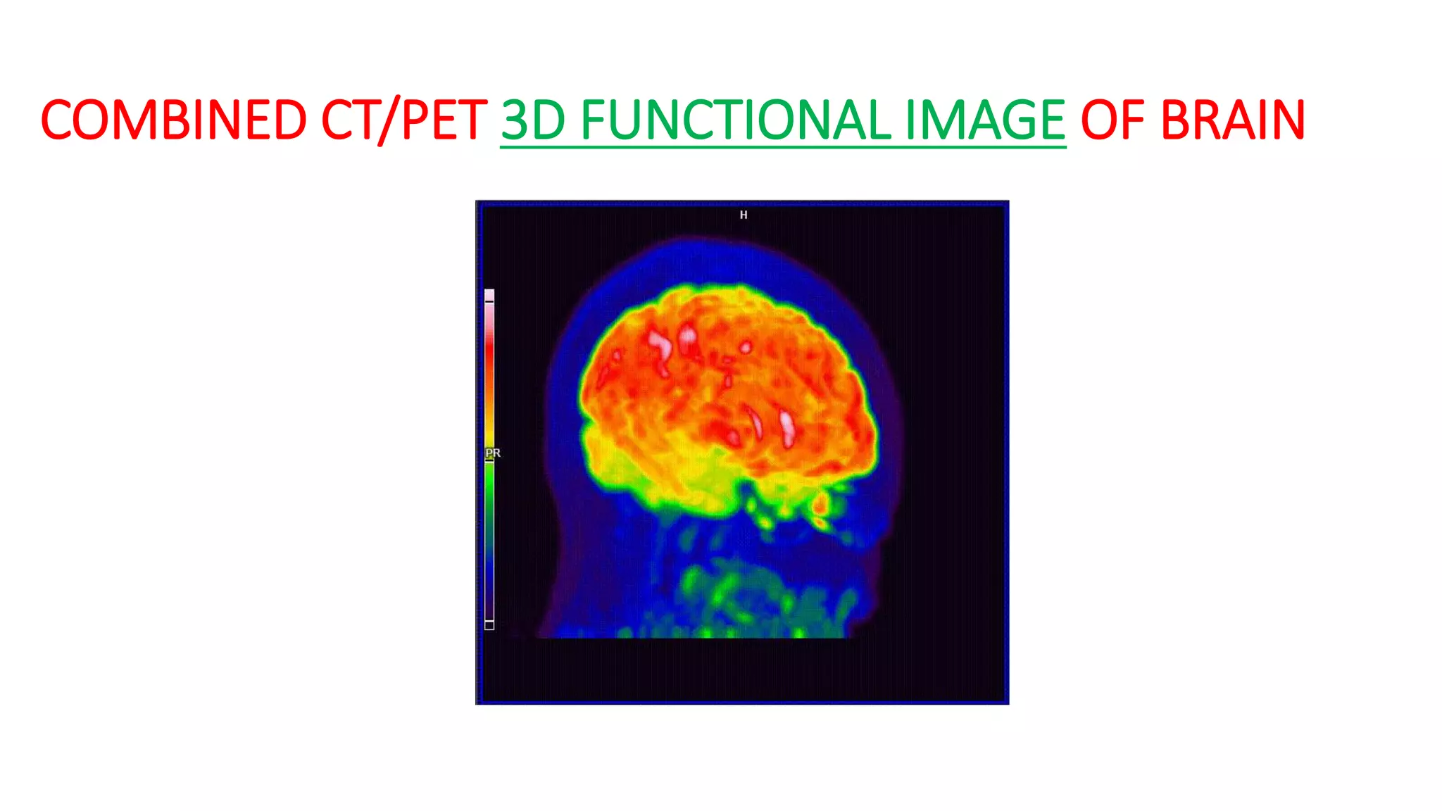 Nuclear medicine PET scan | PPTX