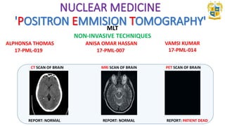 Nuclear medicine PET scan | PPTX