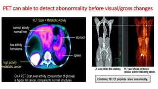 Nuclear medicine PET scan | PPTX
