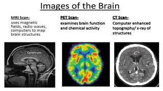Nuclear medicine PET scan | PPTX