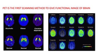 Nuclear medicine PET scan | PPTX