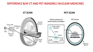 Nuclear medicine PET scan | PPT