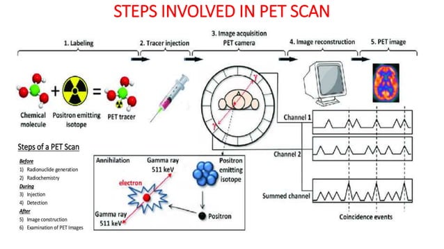 Nuclear medicine PET scan