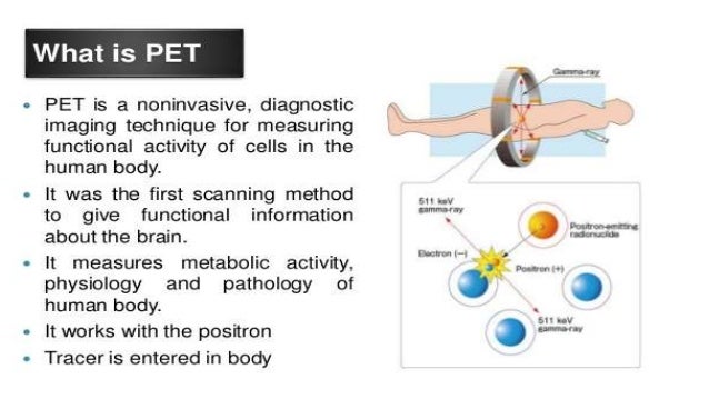 Nuclear medicine PET scan